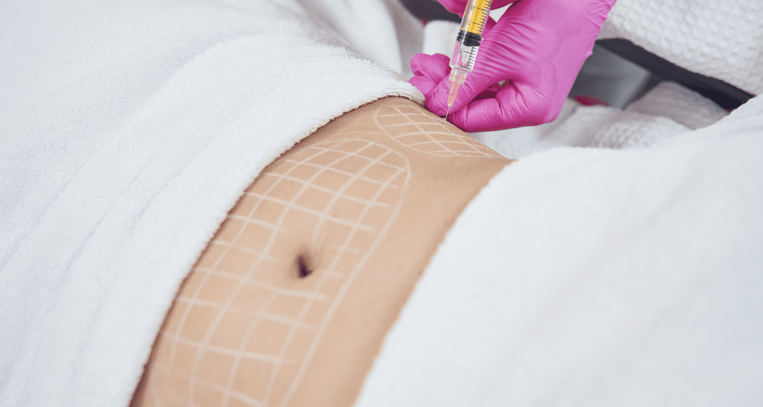 What is Body Contouring? - Classy Cosmetic Clinic